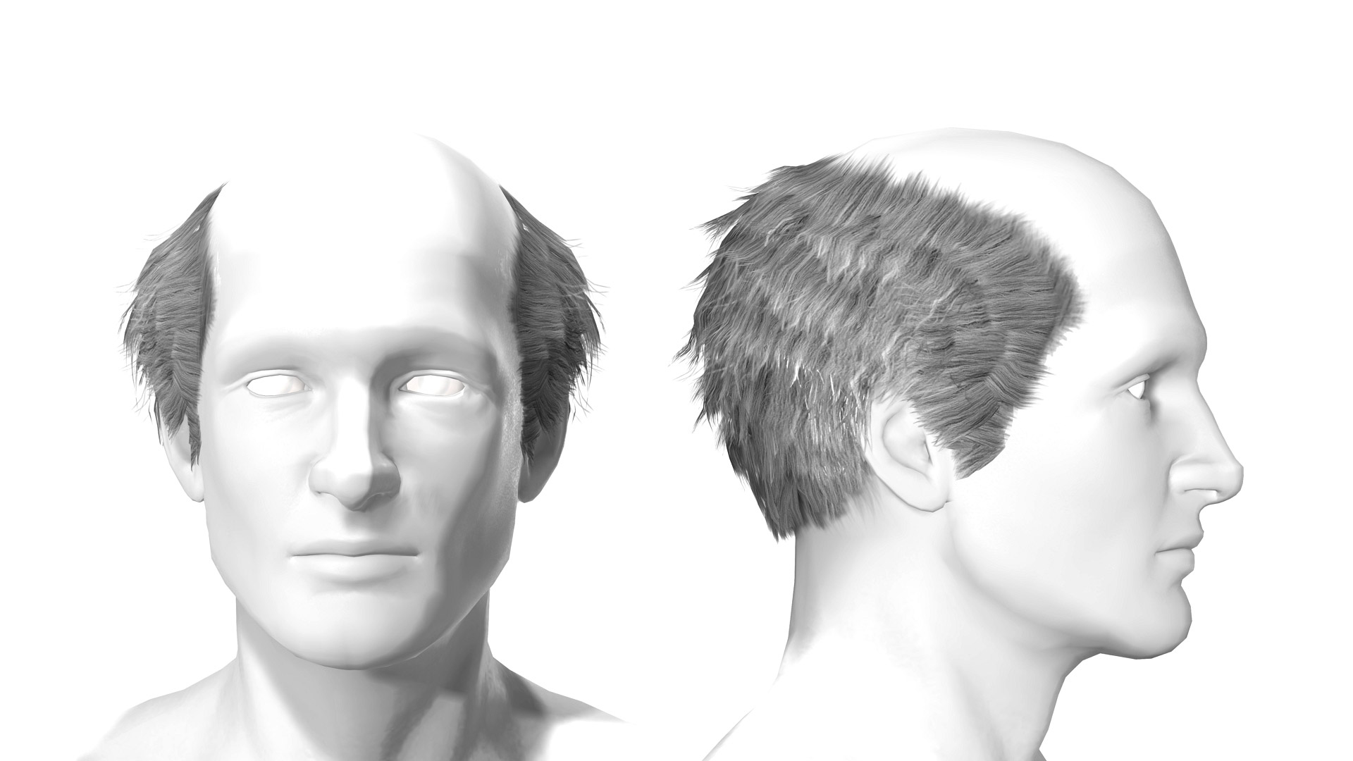 Bald - Character Creator/Hair - Reallusion Content Store