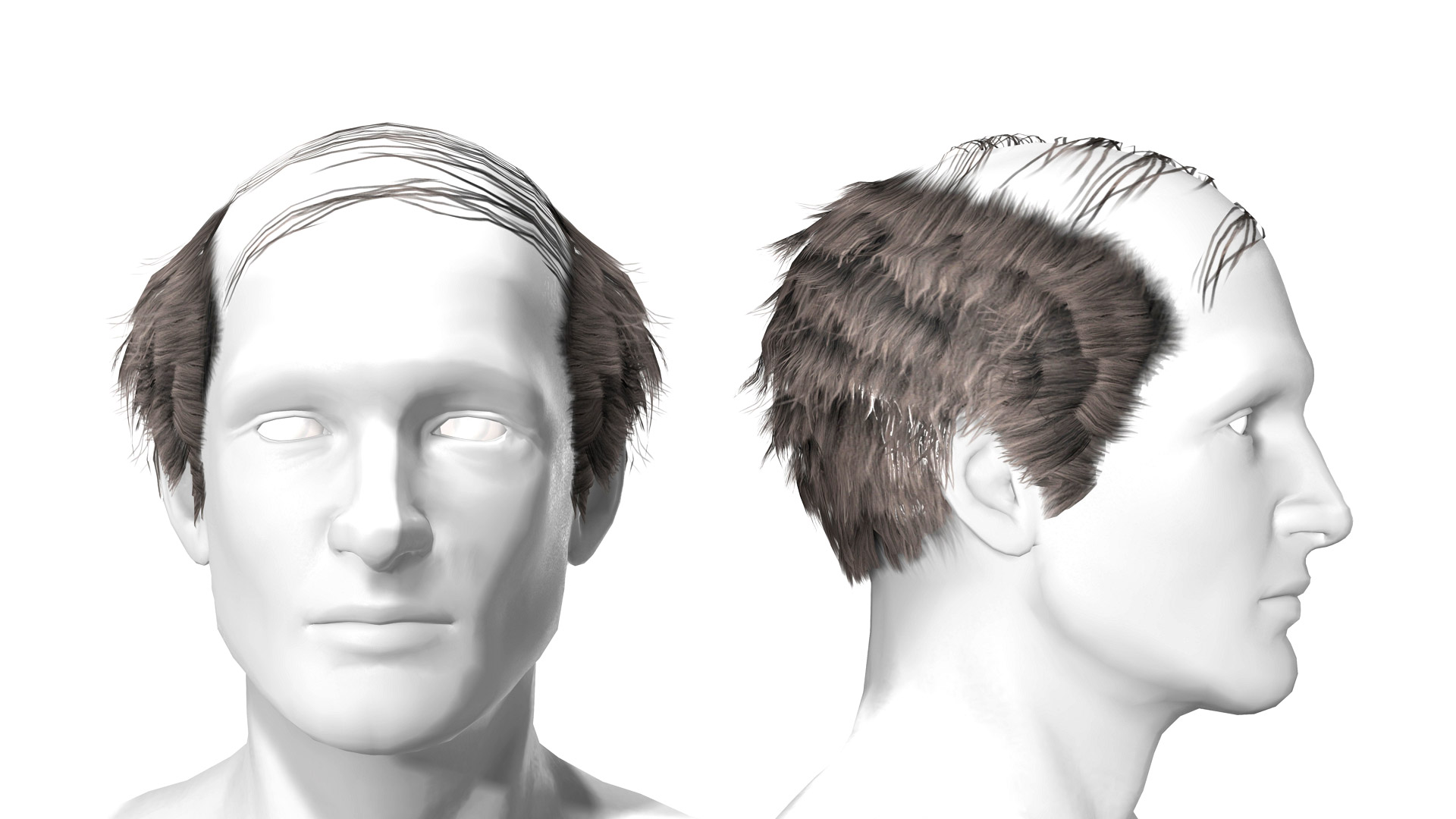 Bald Comb-over - Character Creator/Hair - Reallusion Content Store