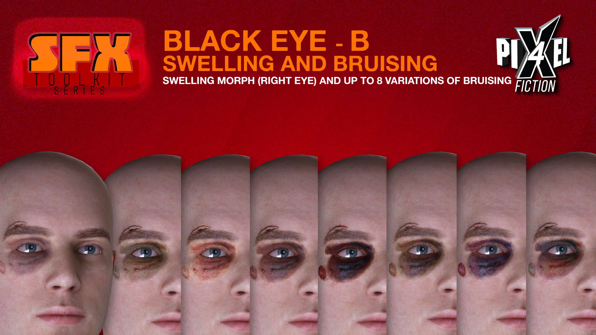 Black Eye B - Swelling and Bruising - Character Creator/Skin ...