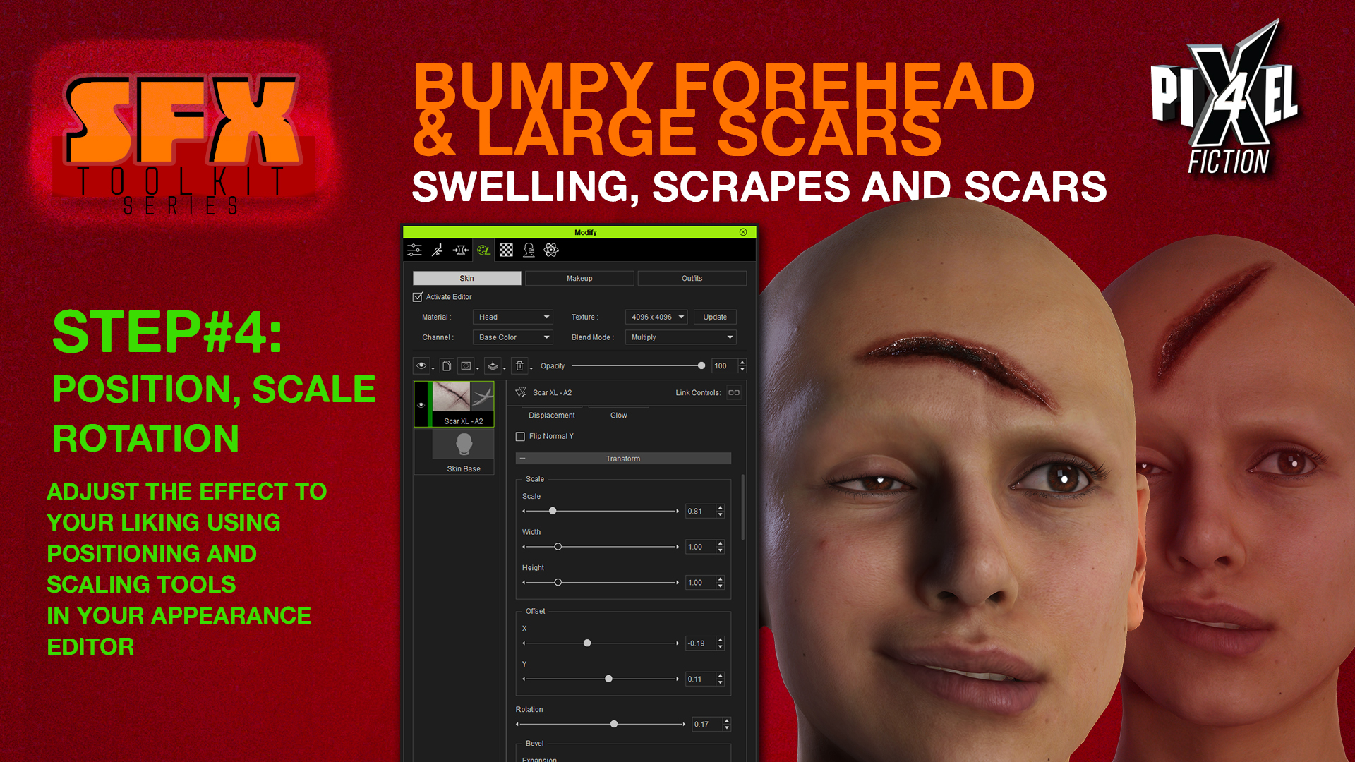 Bumpy Forehead and Large Scars - Character Creator/Skin - Reallusion ...