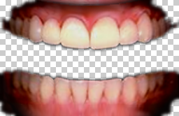 Creating Custom Teeth